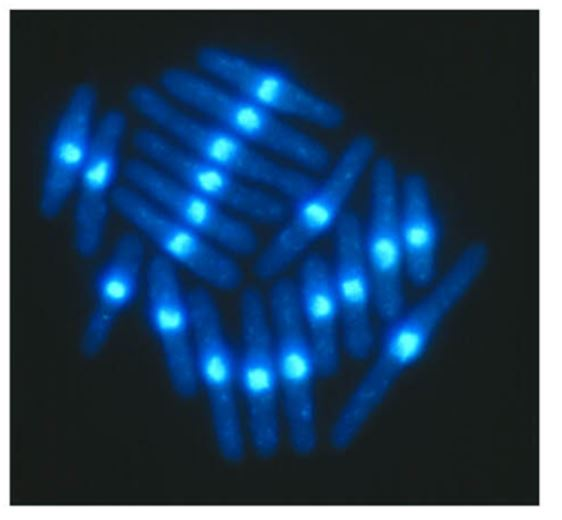 The wild type (normal) S. pombe yeast cells in the | Chegg.com