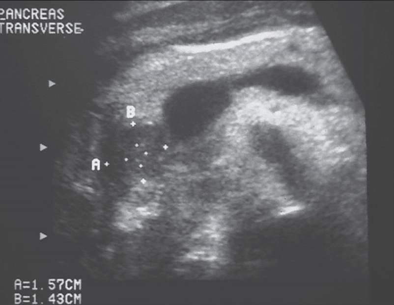 Solved Describe the sonographic appearance of the pancreas | Chegg.com