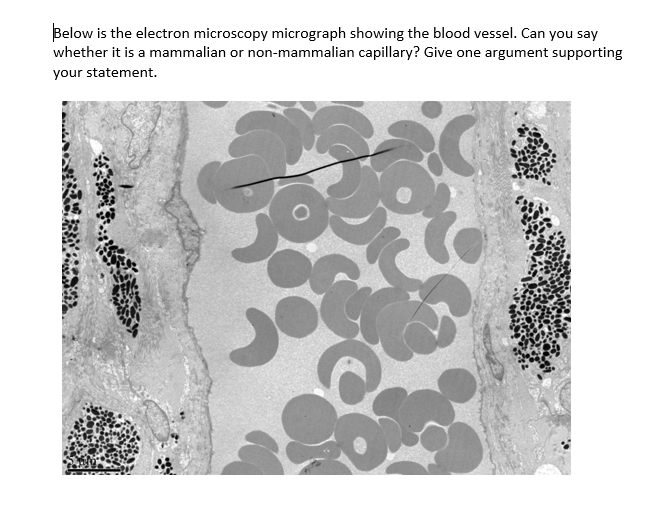 Solved Below is the electron microscopy micrograph showing | Chegg.com