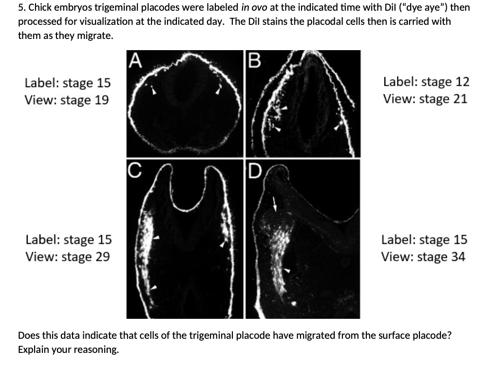 5. Chick embryos trigeminal placodes were labeled in | Chegg.com