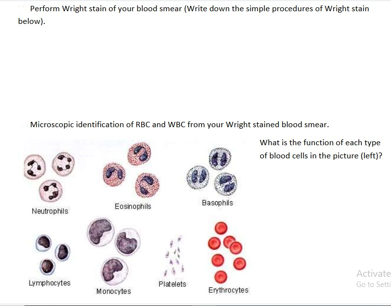 Solved Perform Wright stain of your blood smear (Write down | Chegg.com