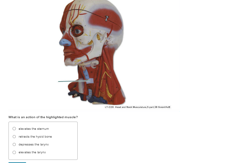 Solved LT-VA16:Life-size Muscle Torso,27-part,3B Scientificß | Chegg.com