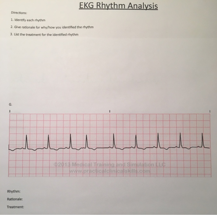 Solved EKG Rhythm Analysi 1. Identify each rhythm 2. Give | Chegg.com