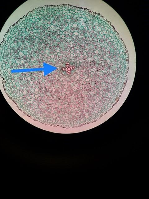 Solved 1.) Ranunculus acris, cross section, 100x: identify | Chegg.com