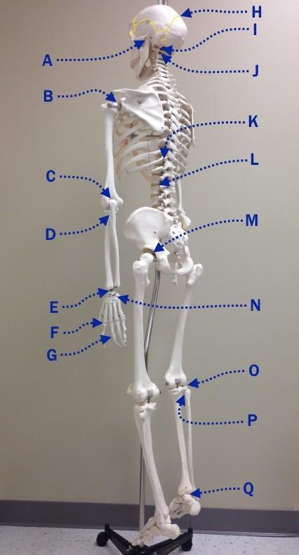 Solved Which of these joints is an example of a plane joint? | Chegg.com