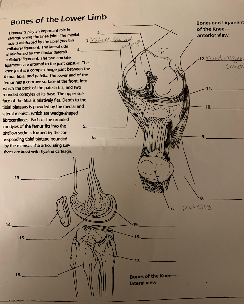 Solved Bones of the Lower Limb 1.. Bones and Ligament of the | Chegg.com