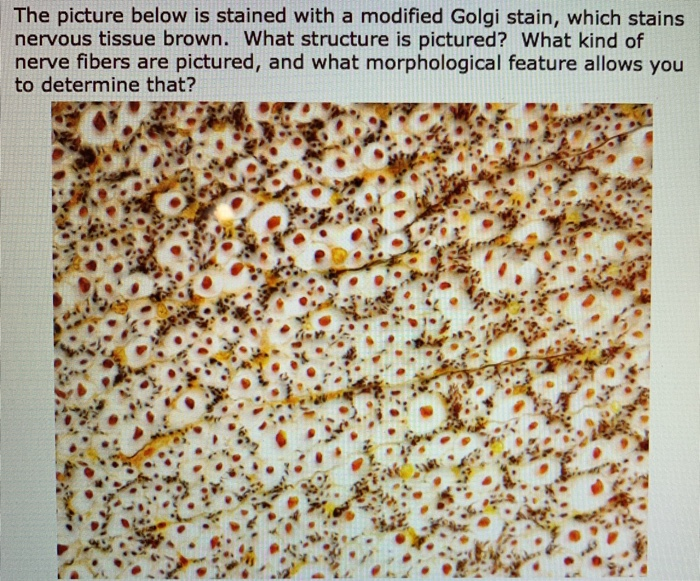 Solved The picture below is stained with a modified Golgi | Chegg.com