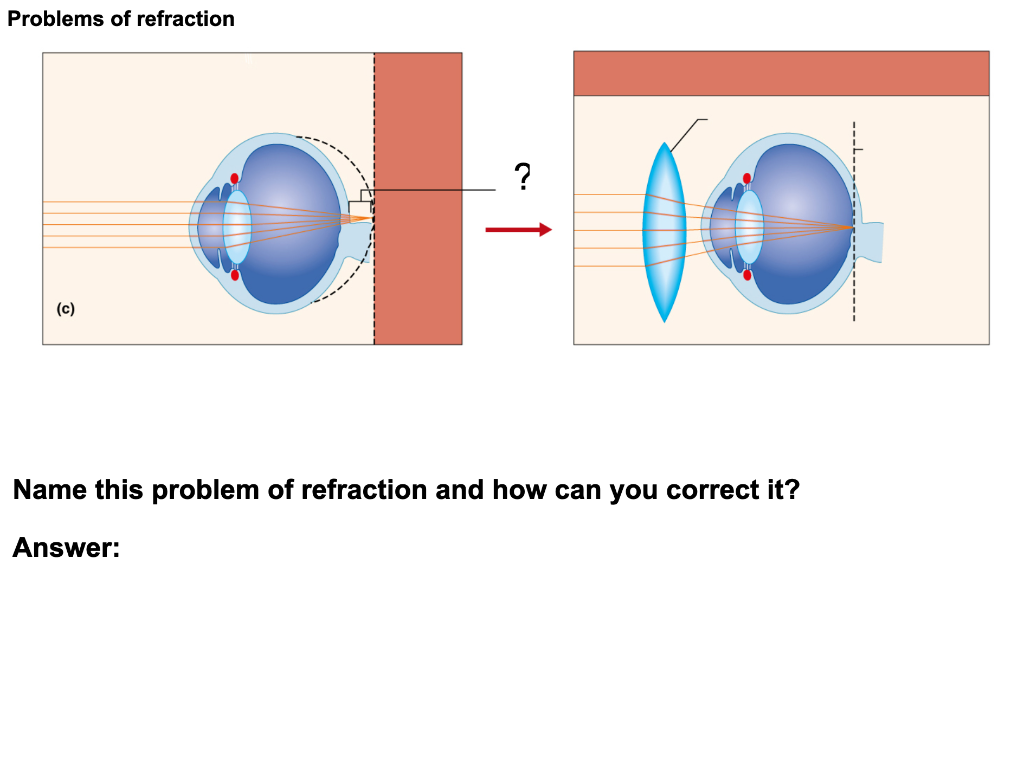 Solved Problems of refraction -? . --L---------------- (b) | Chegg.com