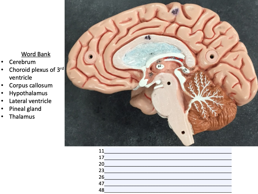 Choroid Plexus Model