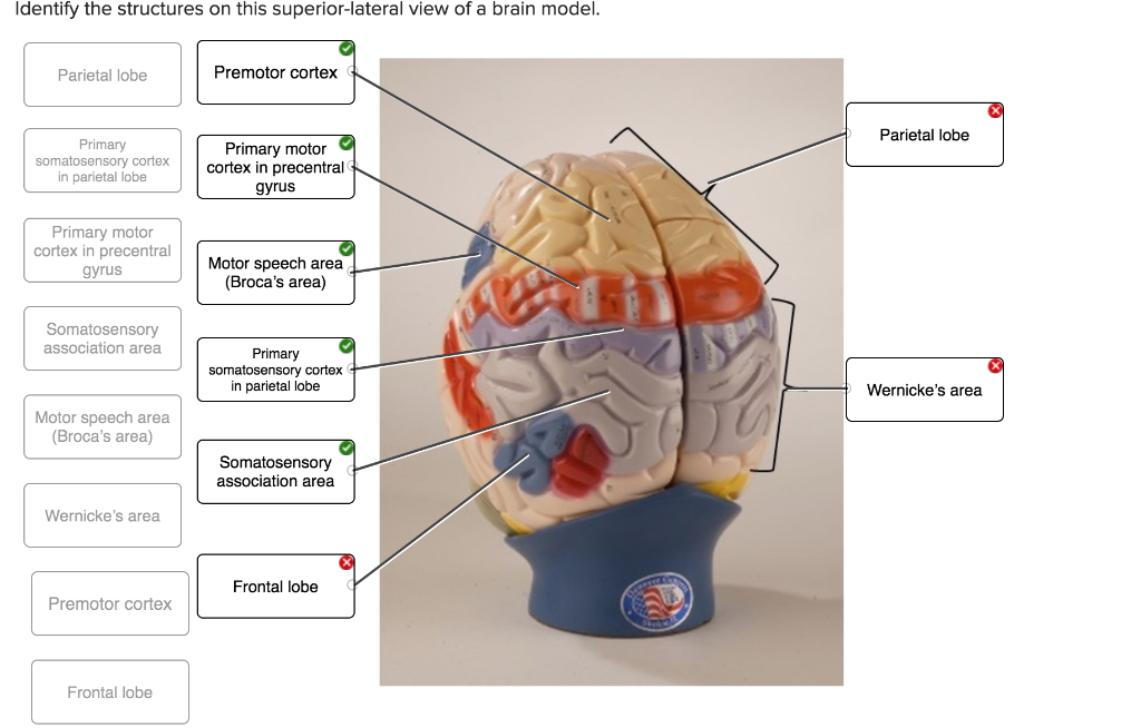 Solved ldentify the structures on this superior-lateral | Chegg.com