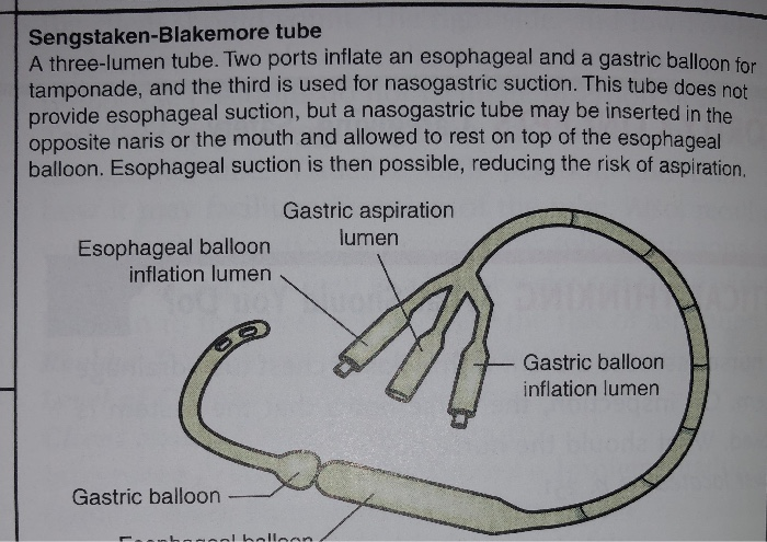 Modified Sengstaken Blakemore Tube