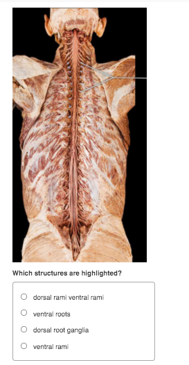 Solved Which structures are highlighted? O dorsal rami | Chegg.com