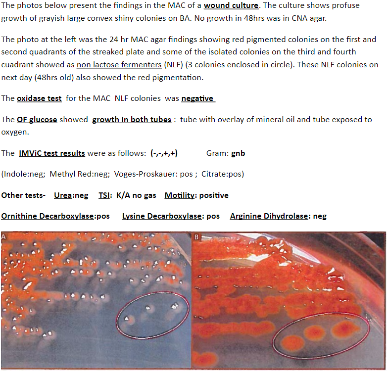 Solved The photos below present the findings in the MAC of a | Chegg.com