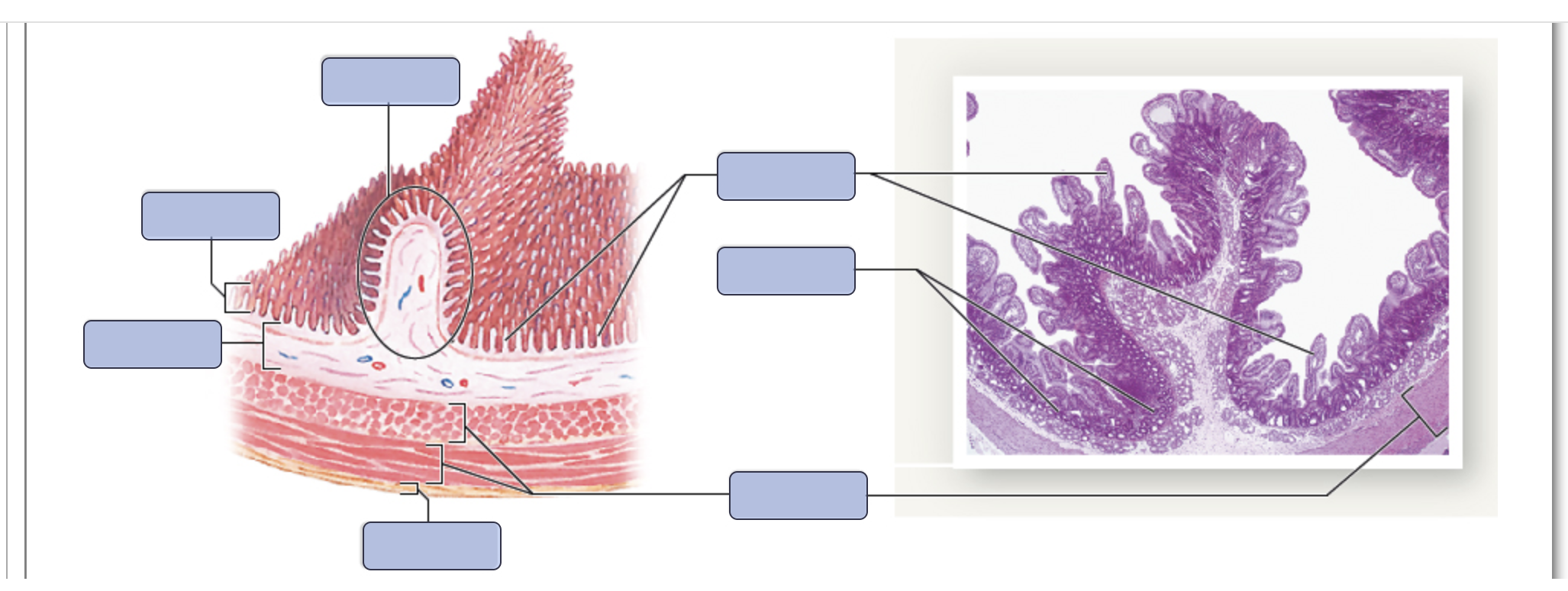 Solved 11 H Plicae circulares Mucosa Intestinal villi | Chegg.com