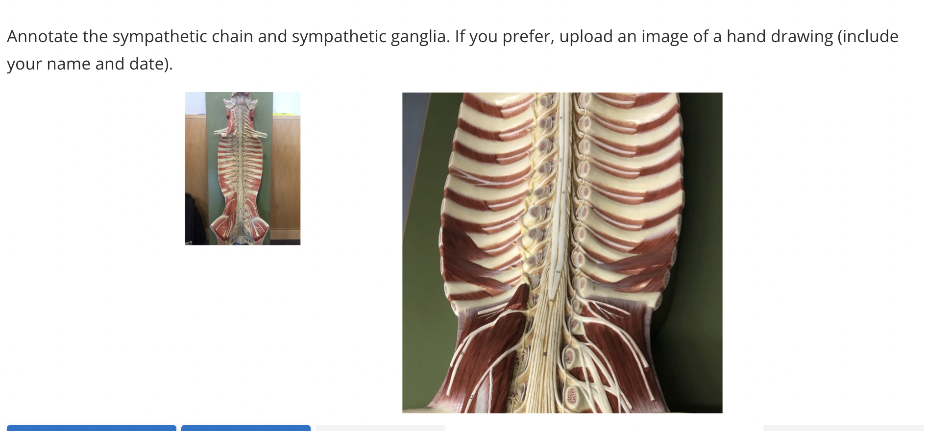 Sympathetic Chain Ganglia Model