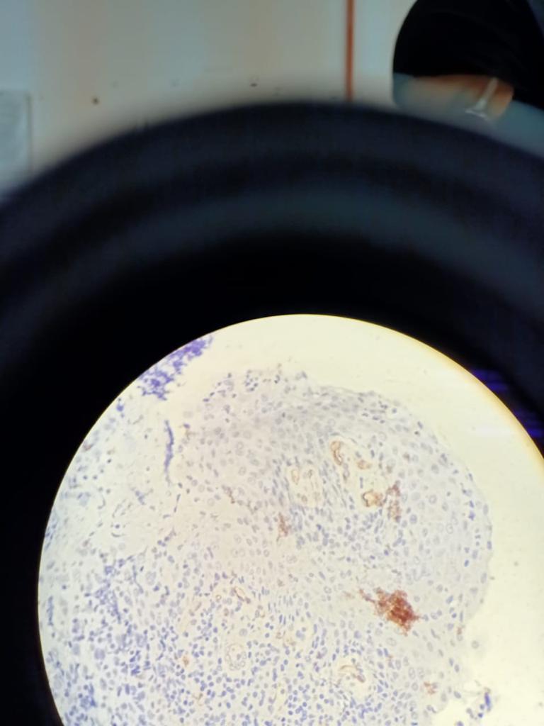 By looking at these images obtained under the | Chegg.com