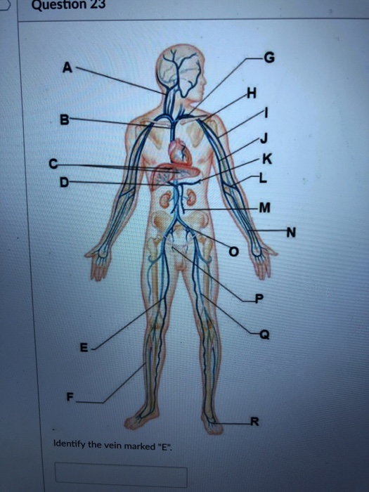 Solved DQuestion 26 ldentify the artery marked Solved DQuestion 26 ldentify the artery marked