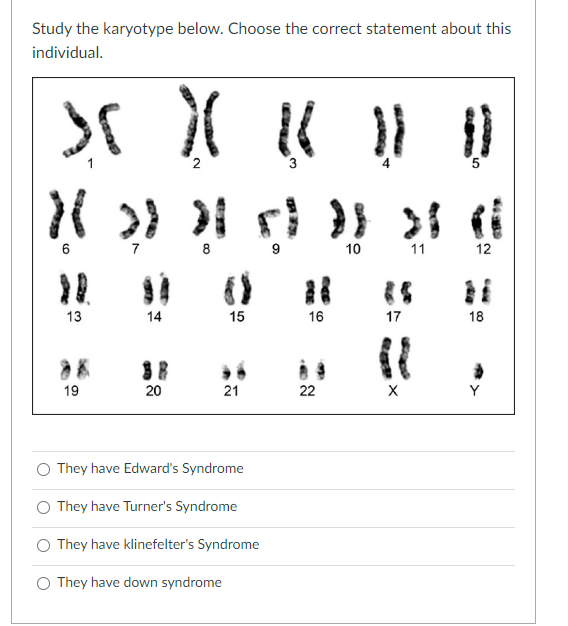 Solved Study the karyotype below. Choose the correct | Chegg.com