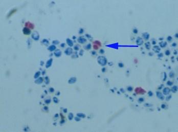 Solved What term is used to describe the septation | Chegg.com