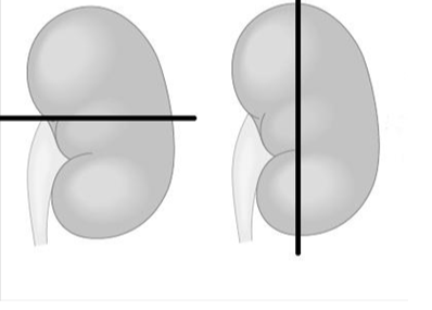 This slide is a picture of the kidney, cut on a | Chegg.com