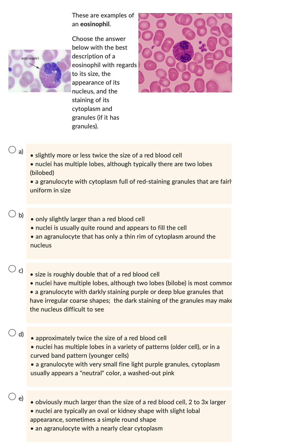 Solved These are examples of a lymphocyte. Choose the answer | Chegg.com