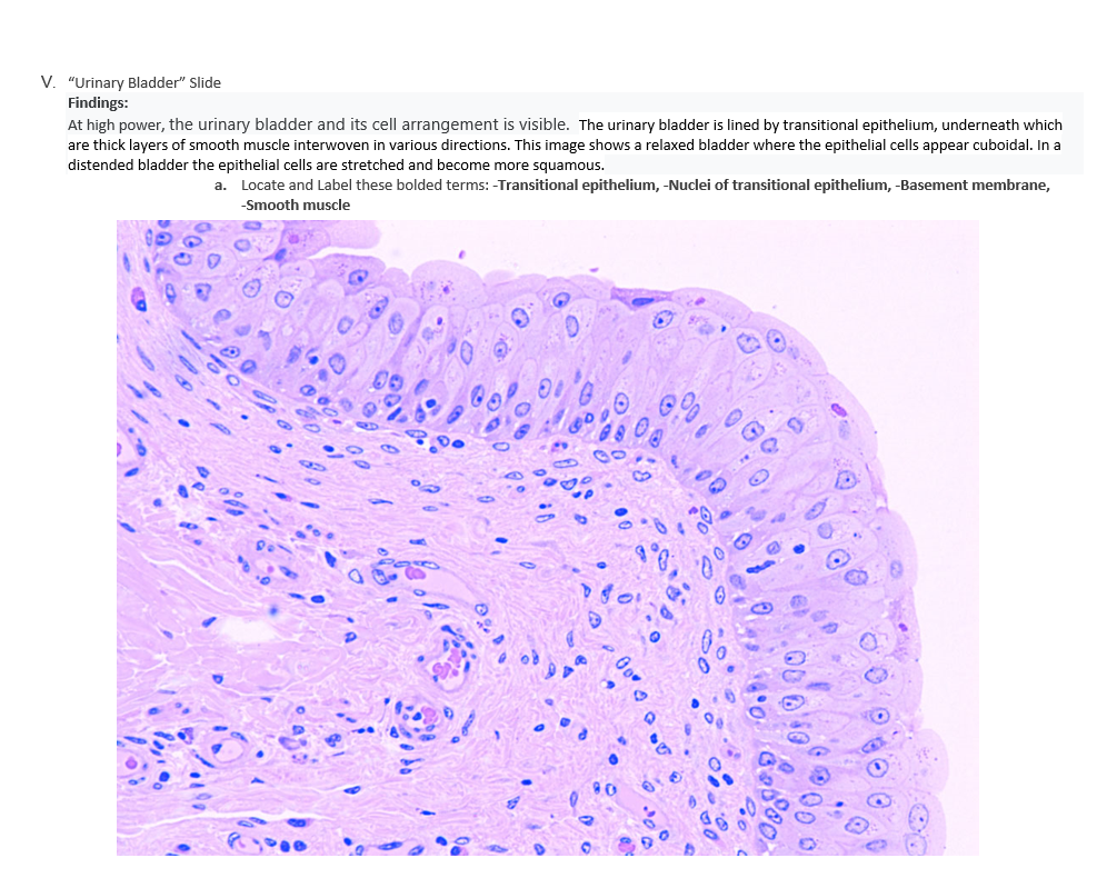 Solved V. "Urinary Bladder" Slide Findings: At high power, | Chegg.com