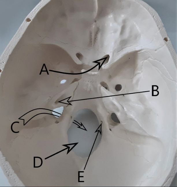Solved 1.The projection "A" is [ Select ] ["zygomatic | Chegg.com
