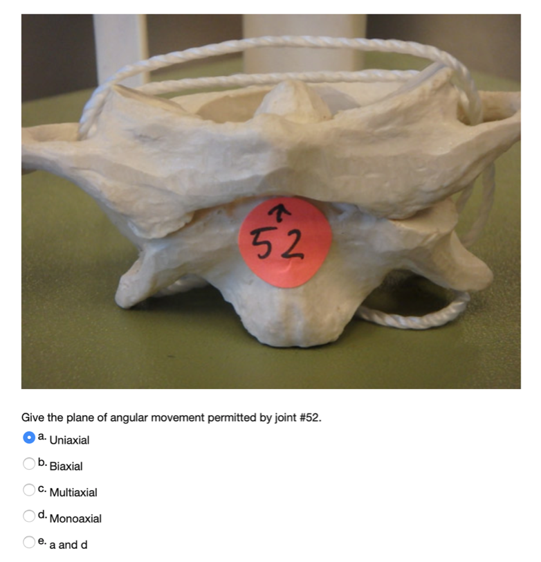 Solved Give the plane of angular movement permitted by joint | Chegg.com