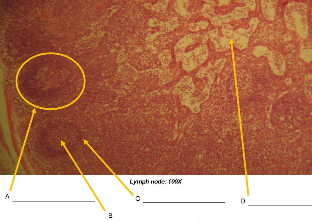 Solved Lymph node: 100x | Chegg.com