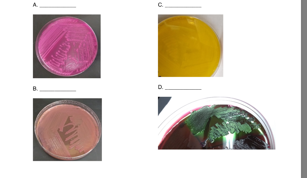 Solved 1. Name media : Mac, EMB or MSA (Name media for | Chegg.com