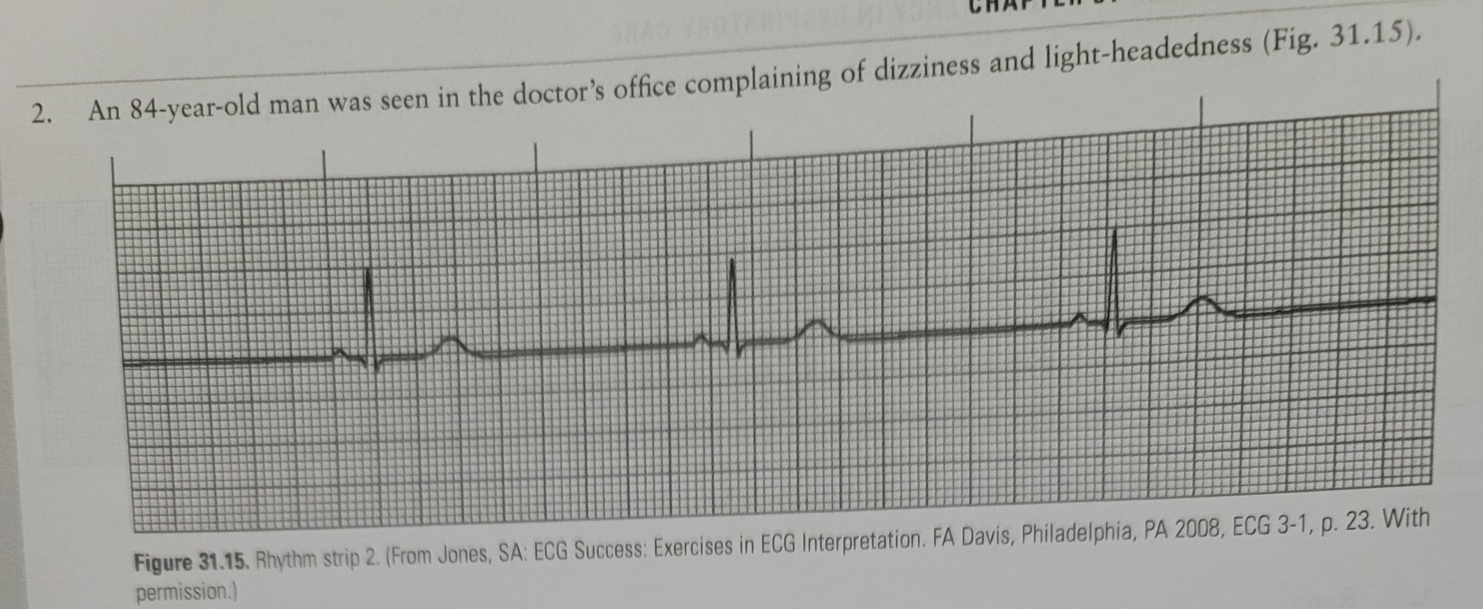 A) Rate:B) Rhythm: regular or irregular?C) P waves: | Chegg.com