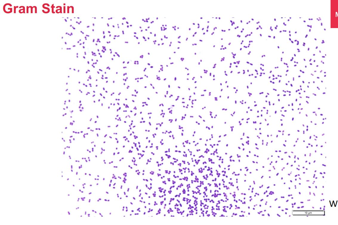 Solved I need assistance identifying this gram stain I know | Chegg.com