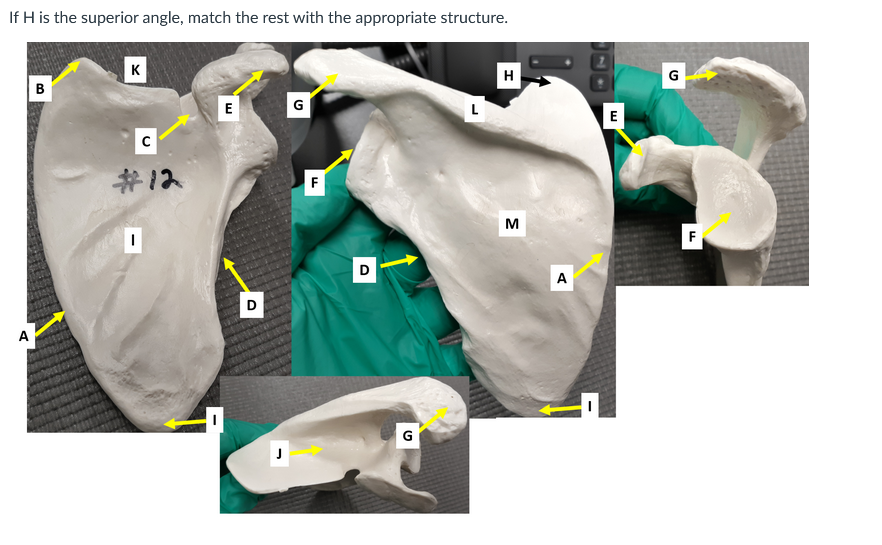 Solved (Options: Coracoid process, Superior border, | Chegg.com