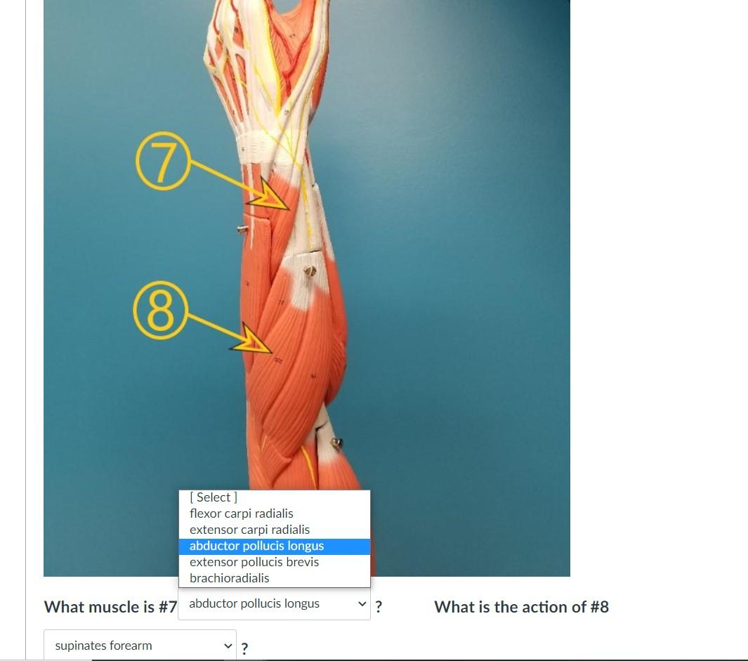 Solved 1−5 (6)Wh: ie action of #8What muscle is #7 abductor | Chegg.com