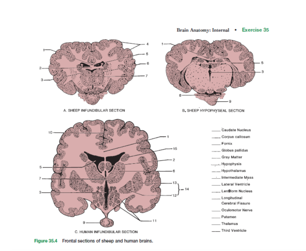 Tentorium Cerebelli Sheep Brain