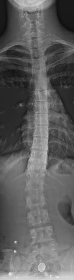 I need a Python program to implement Convolutional | Chegg.com