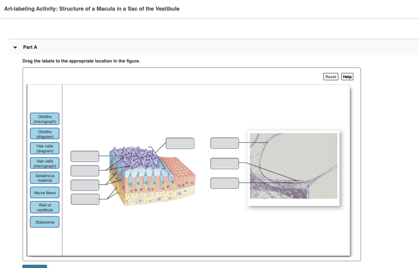 Solved Art-labeling Activity: Structure of a Macula in a Sac | Chegg.com