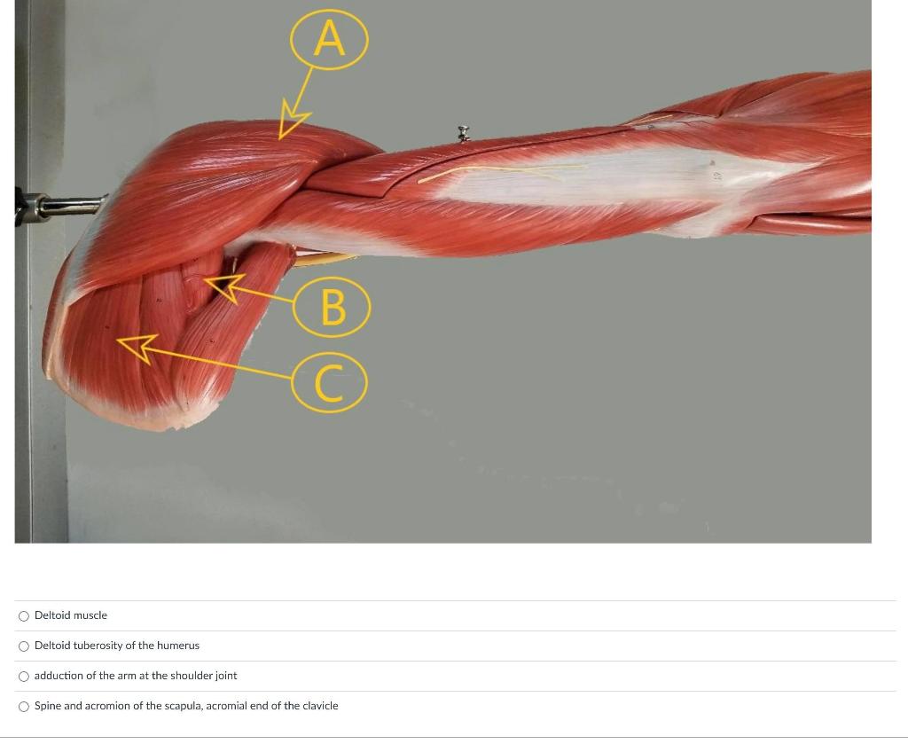 Solved Question 1 A) What origin? A B 1 pts A B O Deltoid | Chegg.com