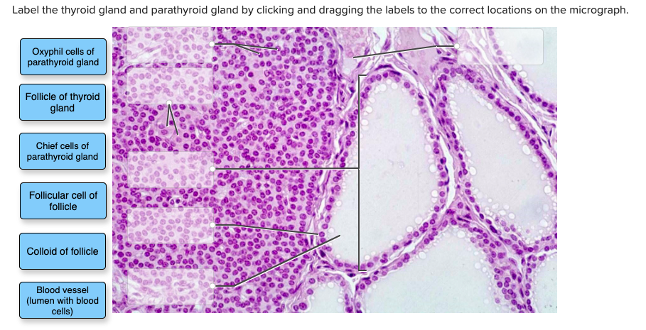 Solved Label the thyroid gland and parathyroid gland by | Chegg.com
