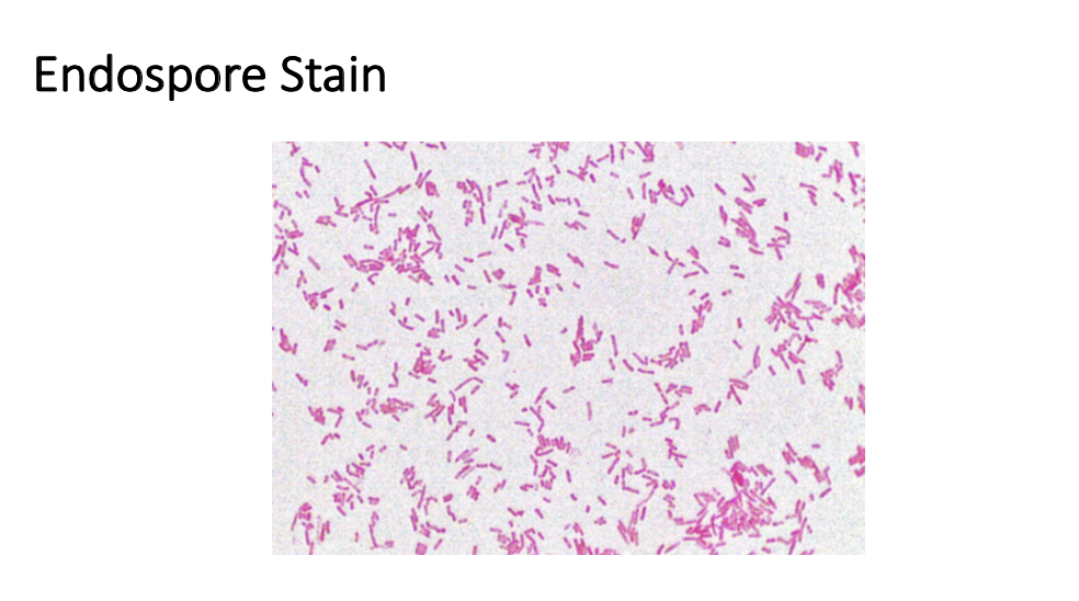 Solved Explain the purpose of a endospore stain. Include a | Chegg.com