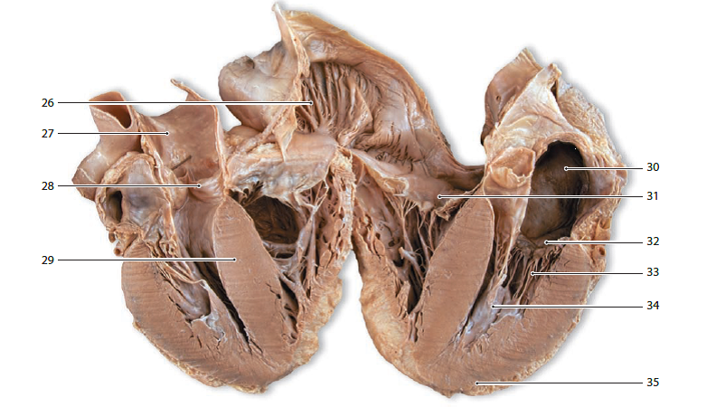 Solved 26 27 30 28 31 32 29 33 34 35 B a. Apex of the | Chegg.com