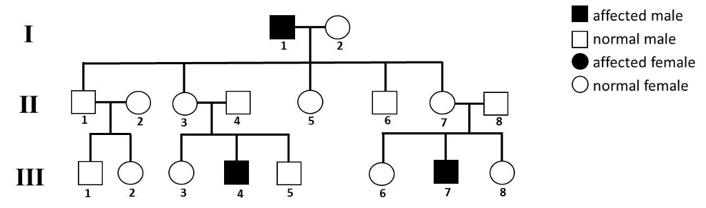 Turner Syndrome Pedigree Chart