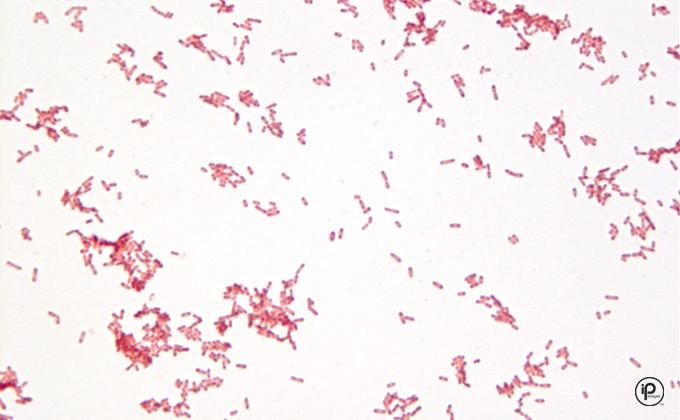 Solved Describe the GRAM NATURE (Colony morphology and | Chegg.com