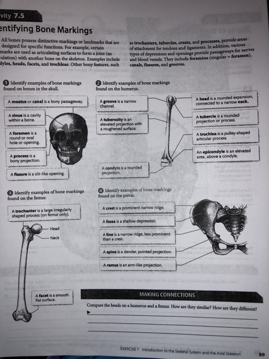 Solved vity 7.5 entifying Bone Markings All bones posses | Chegg.com