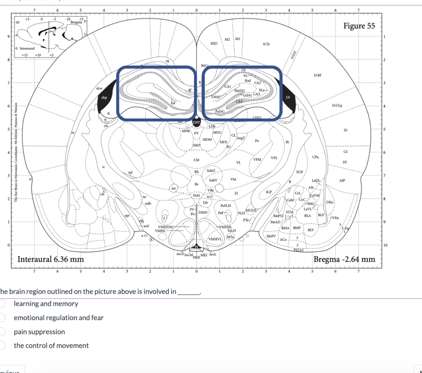 Solved The brain region outlined on the picture above is | Chegg.com