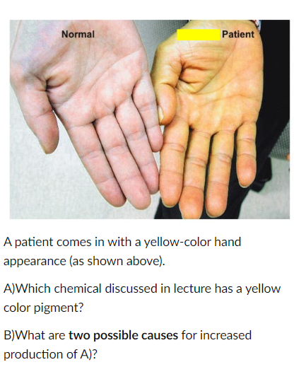 Solved Normal Patient A patient comes in with a yellow-color | Chegg.com