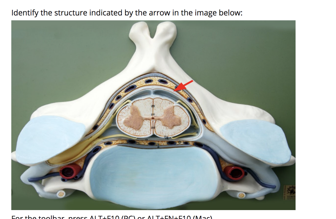 Solved Identify the structure indicated by the arrow in the | Chegg.com