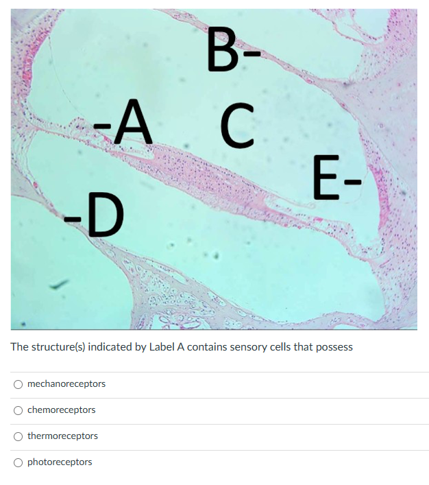 Solved The structure(s) indicated by Label A contains | Chegg.com