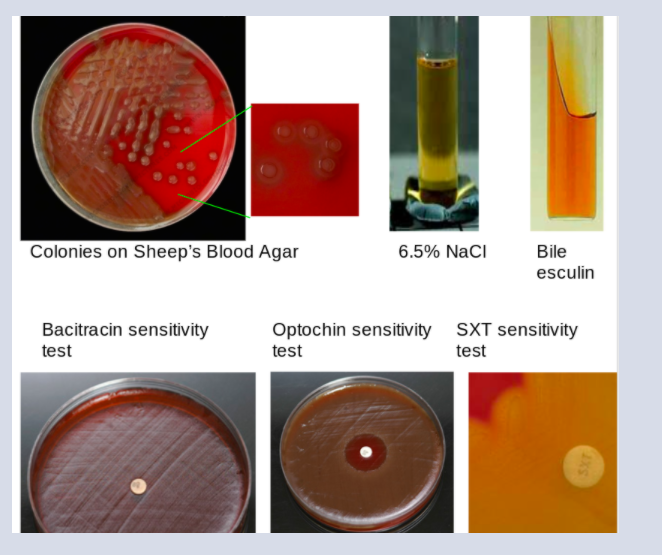 Solved Colonies on Sheep's Blood Agar 6.5% NaCl Bile esculin | Chegg.com