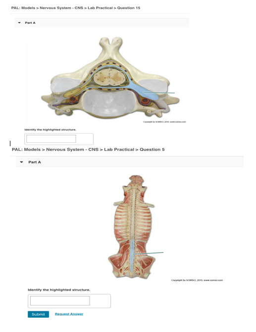 Solved PAL: Models > Nervous System - CNS > Lab Practical > | Chegg.com